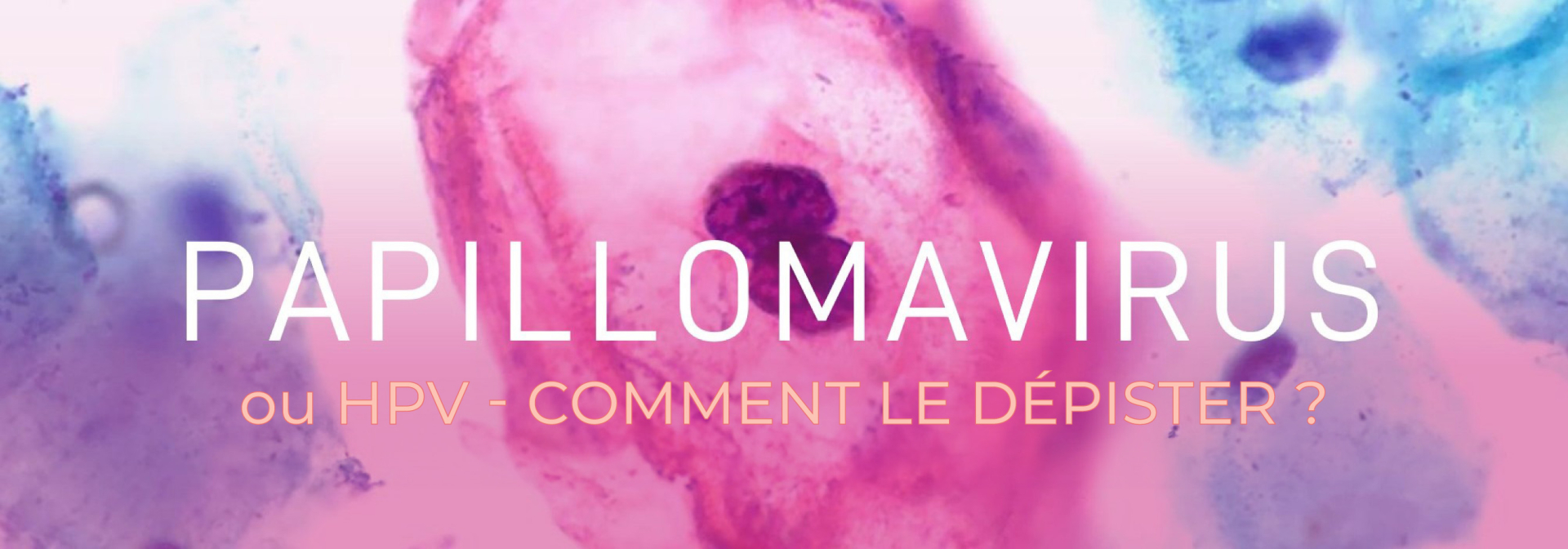 L'infection à papillomavirus humains (HPV), cause de Cancer du col de l ...